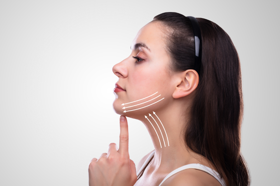 PDO Thread Lift - Fortitude Health Spa